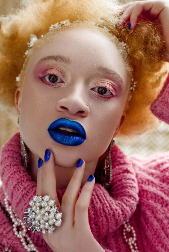 Albino Model Mirian Njoh Shatters All Beauty Stereotypes On The Cover ...
