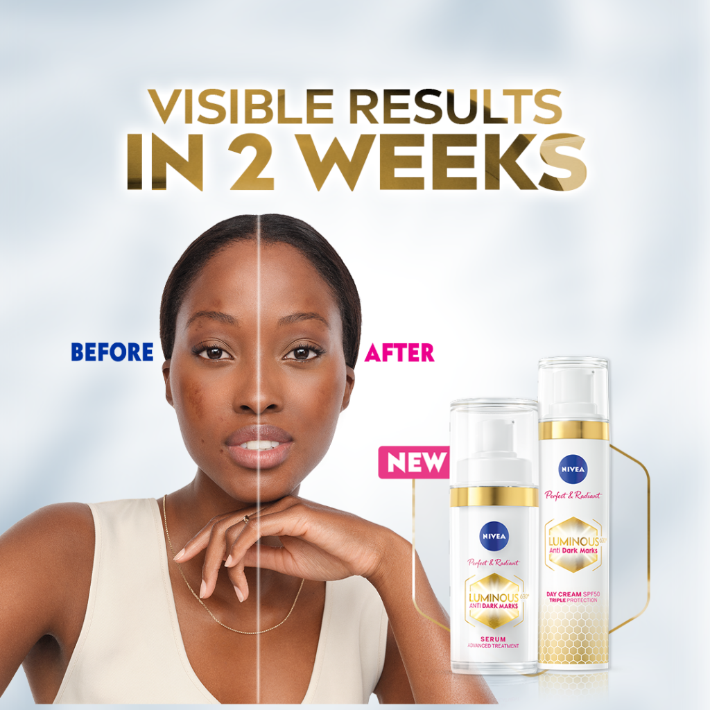 Defeat Hyperpigmentation with NIVEA Perfect & Radiant Luminous630 Anti ...